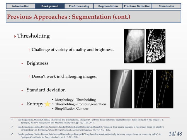 Master Thesis Long Bone Segmentation And Fracture Detection In X Ray