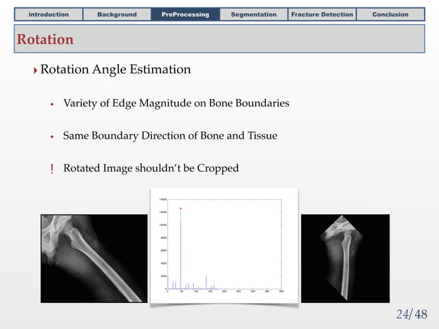 Master thesis - Long Bone Segmentation and Fracture Detection in X-ray Images | PDF