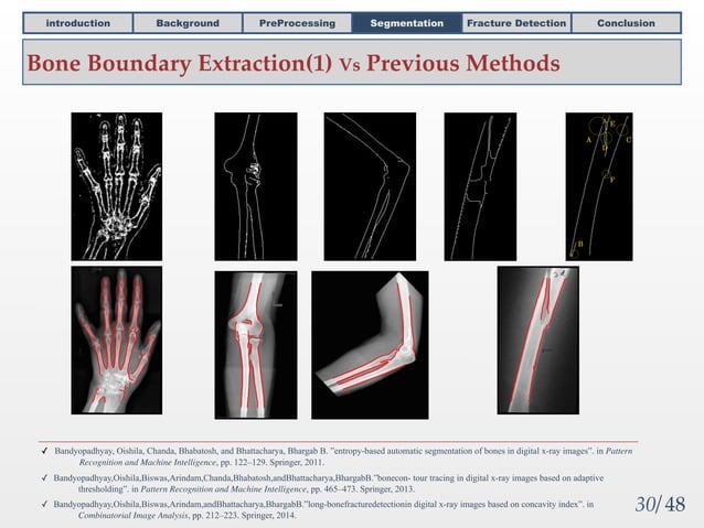 Master Thesis Long Bone Segmentation And Fracture Detection In X Ray