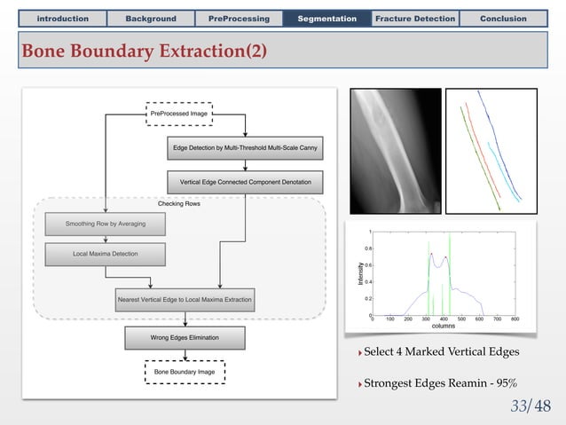 Master thesis - Long Bone Segmentation and Fracture Detection in X-ray Images | PDF