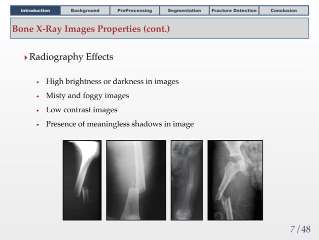 Master thesis - Long Bone Segmentation and Fracture Detection in X-ray Images | PDF