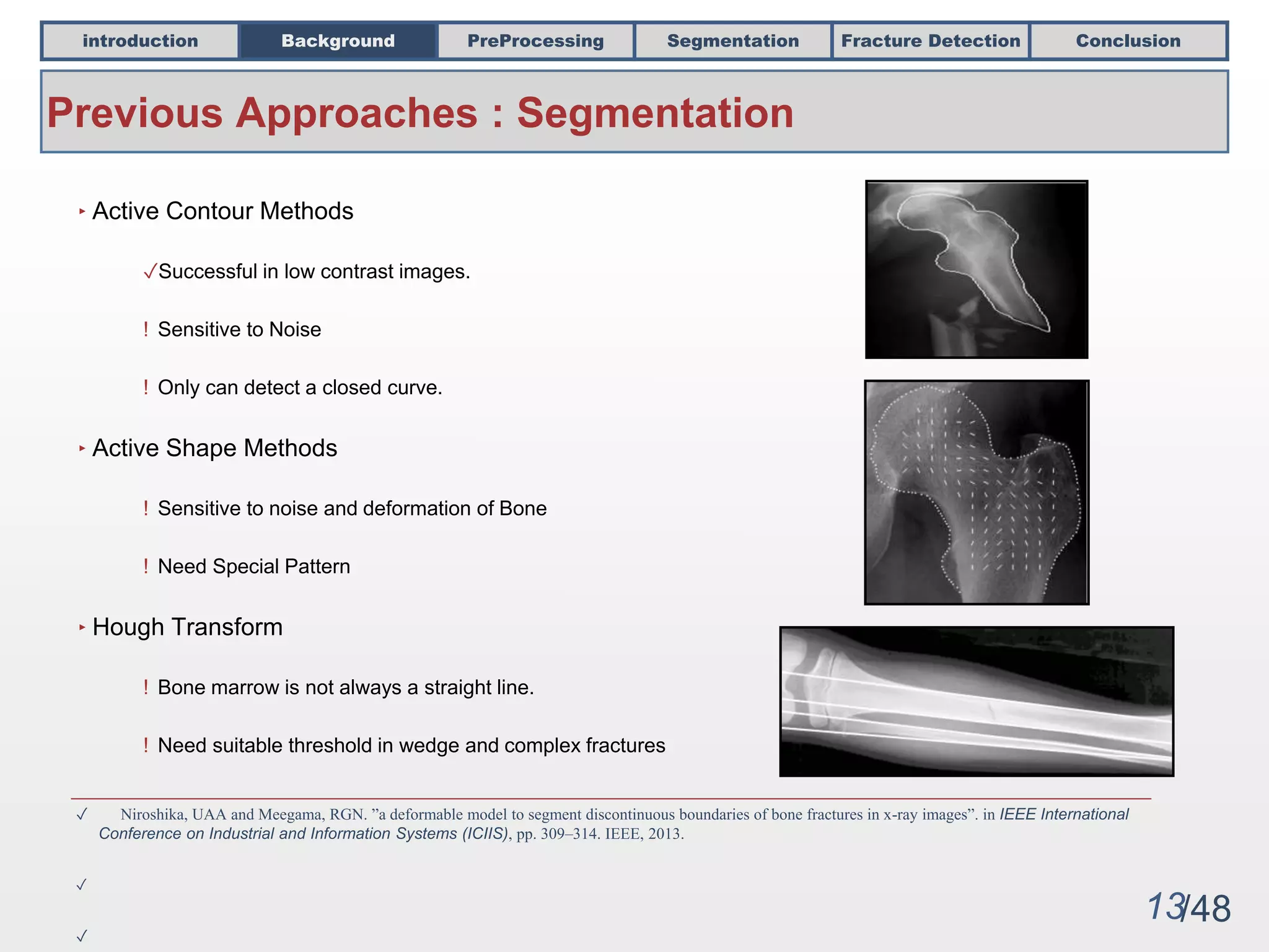 Master thesis - Long Bone Segmentation and Fracture Detection in X-ray ...