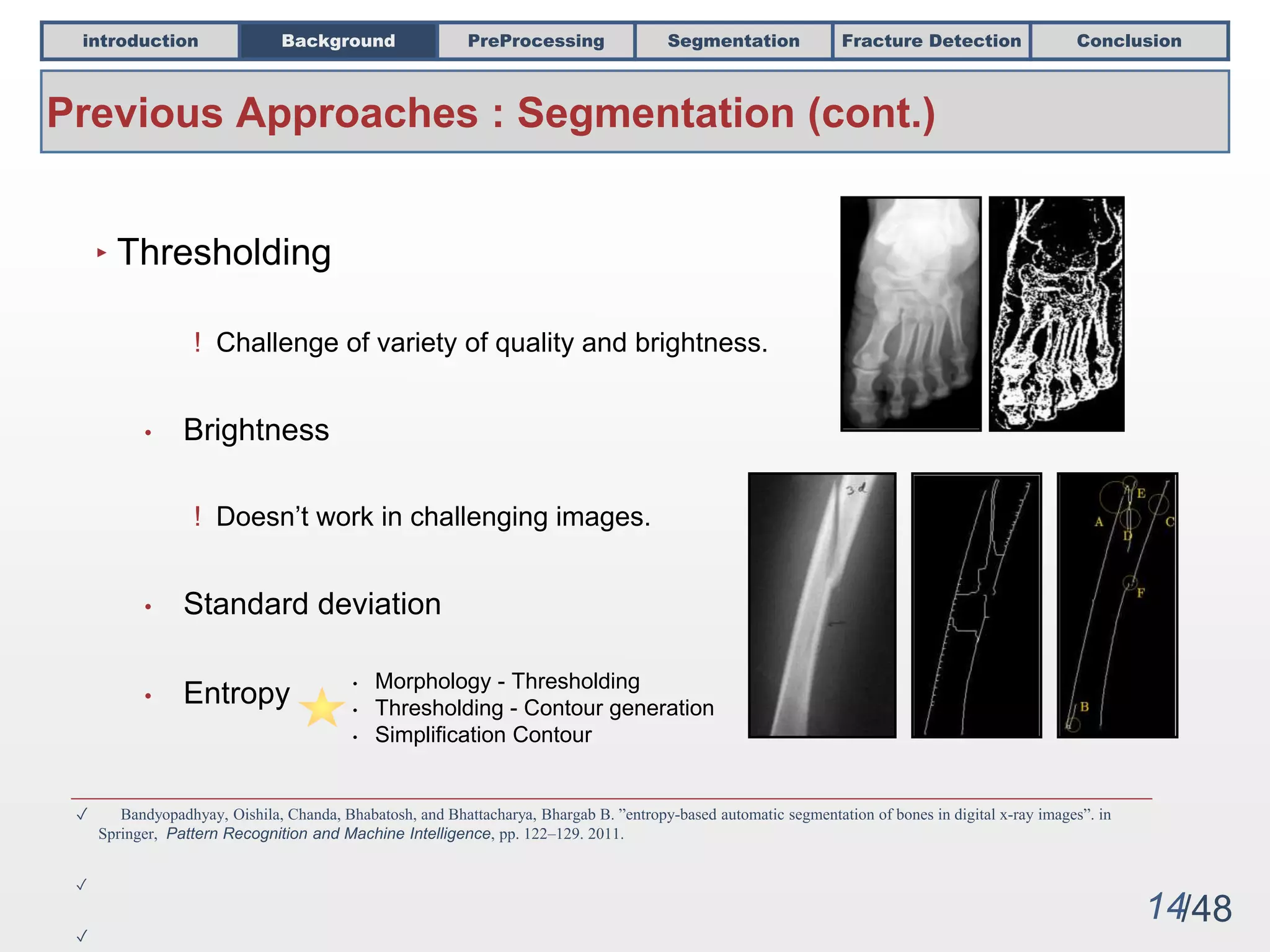 Master thesis - Long Bone Segmentation and Fracture Detection in X-ray Images | PPT
