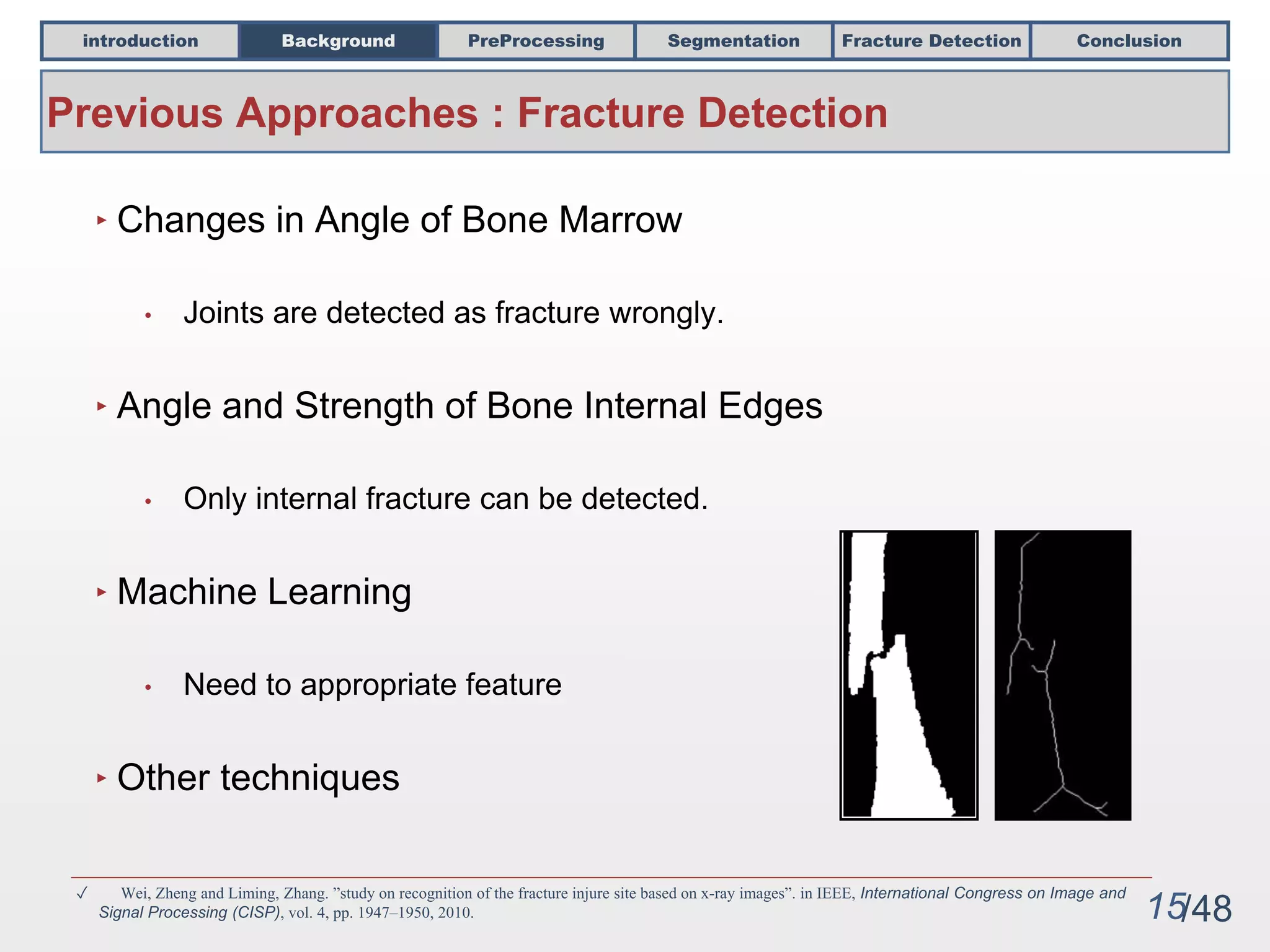 Master thesis - Long Bone Segmentation and Fracture Detection in X-ray Images | PPT