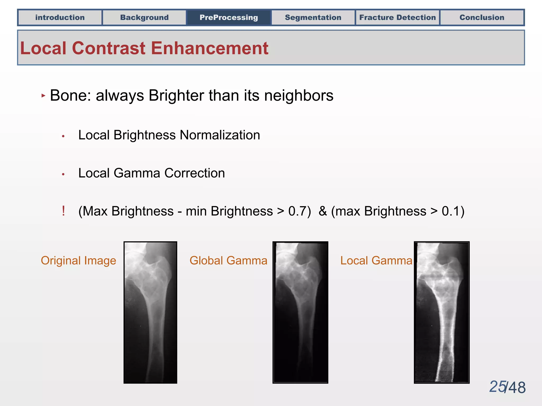 Master thesis - Long Bone Segmentation and Fracture Detection in X-ray ...