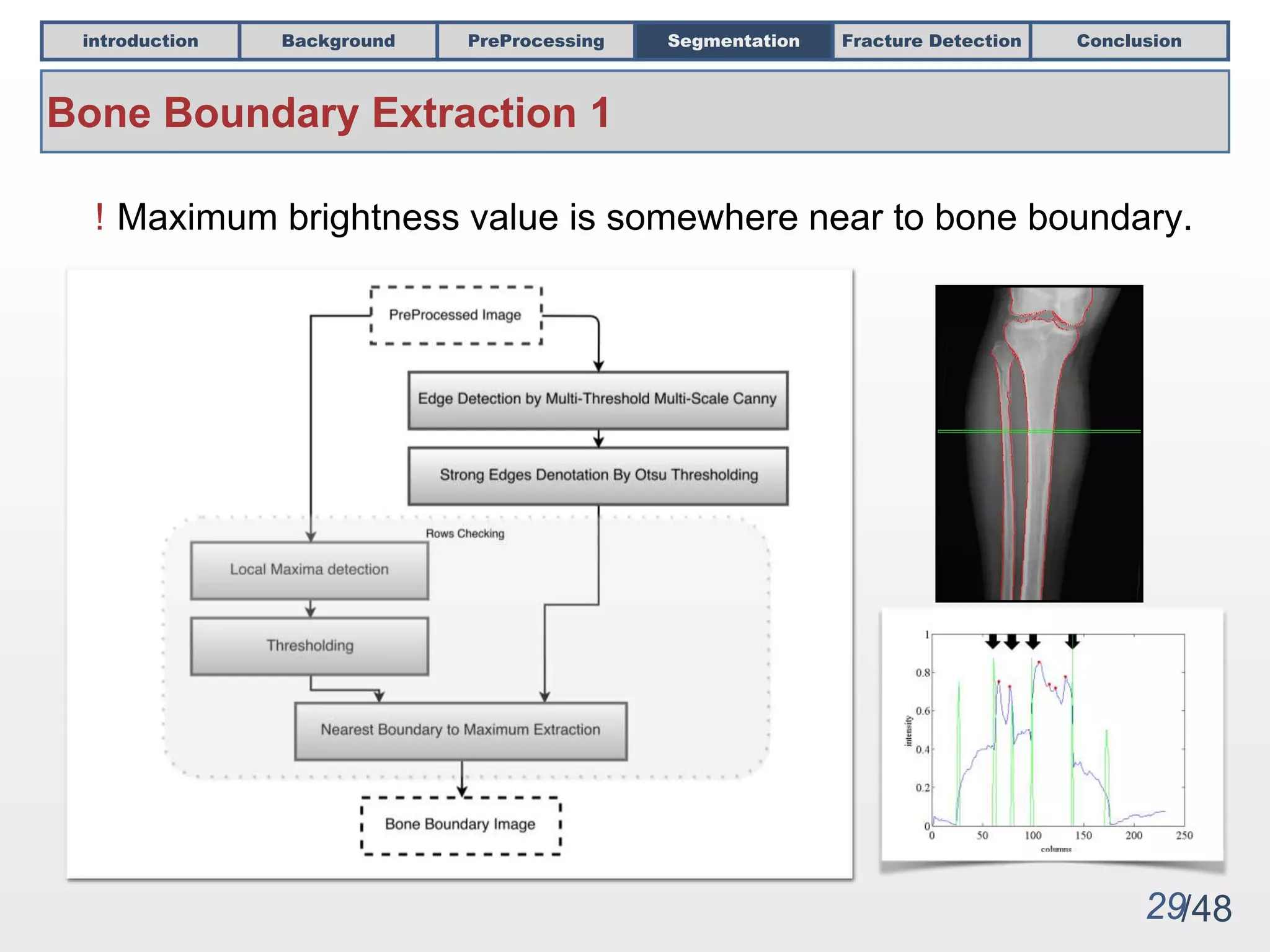 Master thesis - Long Bone Segmentation and Fracture Detection in X-ray Images | PPT