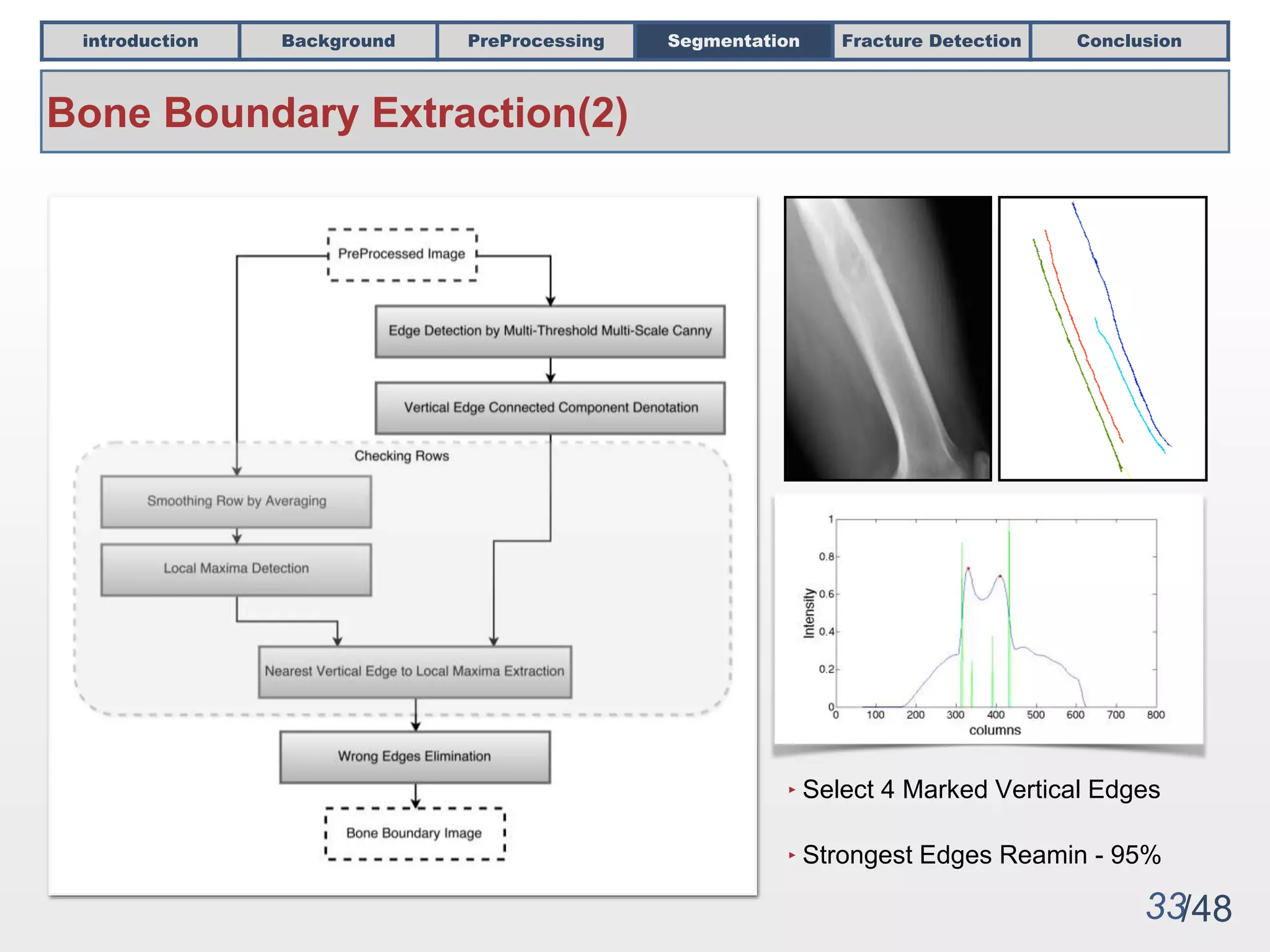 Master thesis - Long Bone Segmentation and Fracture Detection in X-ray Images | PPT
