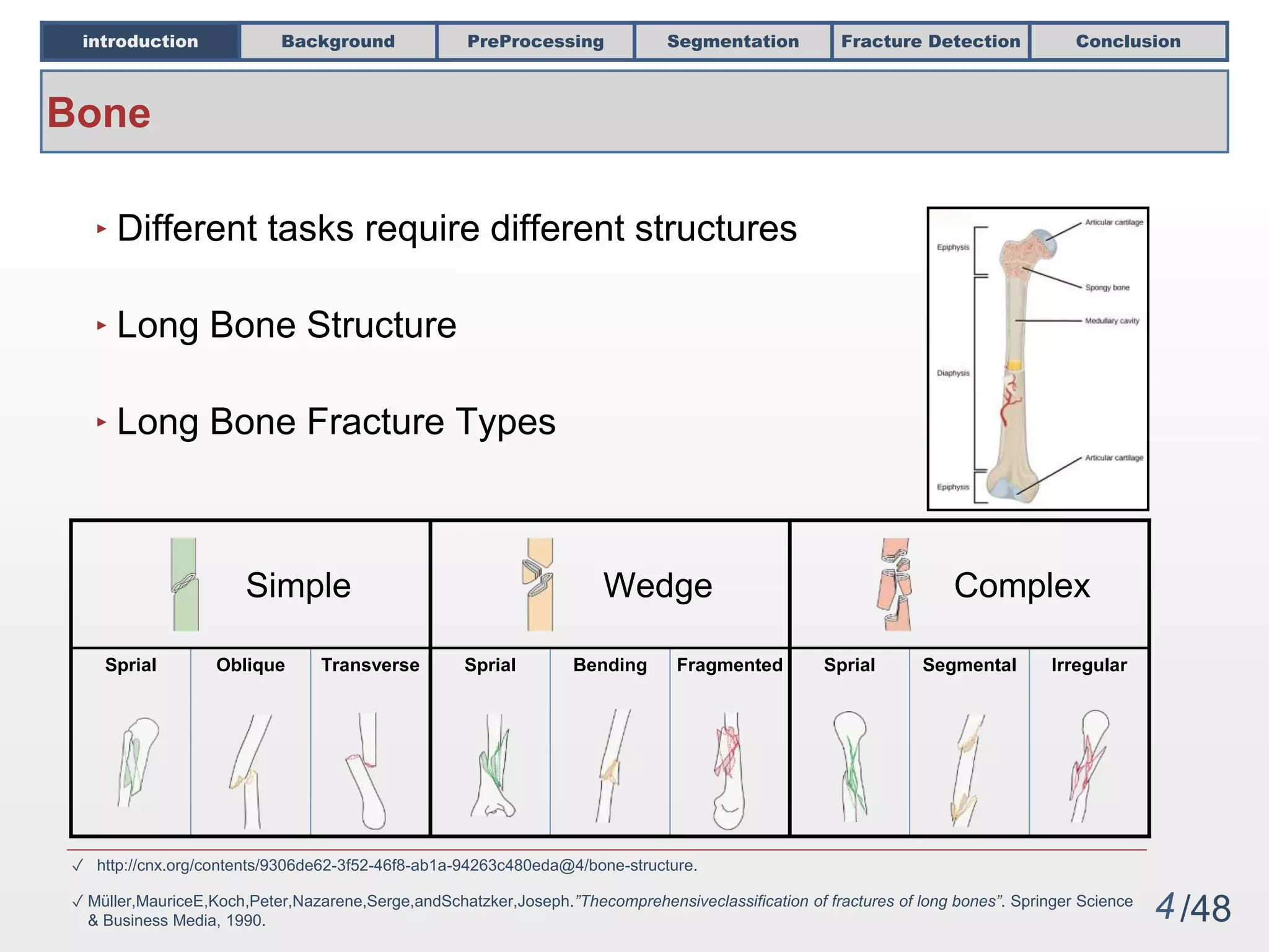 Master thesis - Long Bone Segmentation and Fracture Detection in X-ray Images | PPT