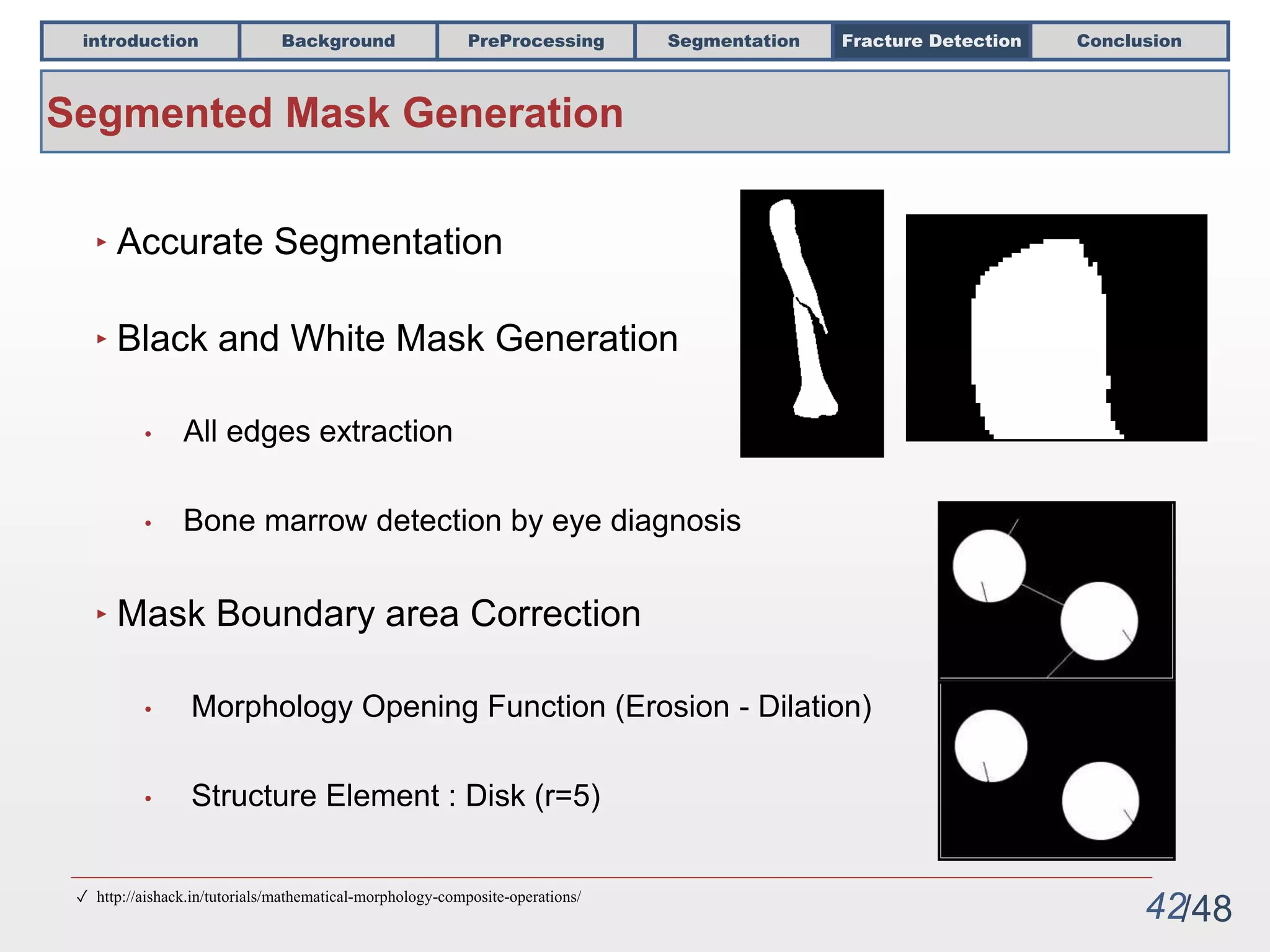 Master thesis - Long Bone Segmentation and Fracture Detection in X-ray Images | PPT