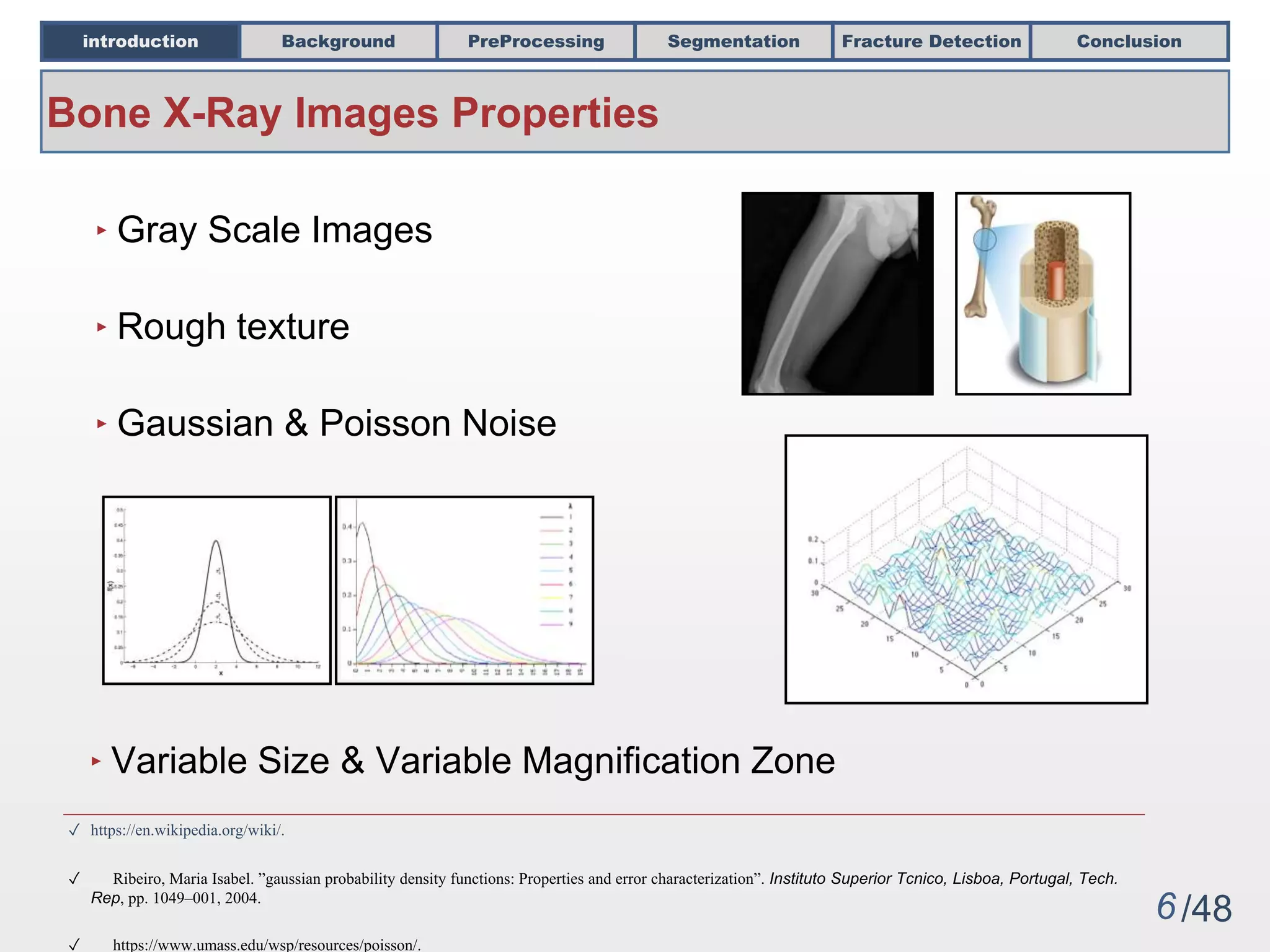 Master thesis - Long Bone Segmentation and Fracture Detection in X-ray ...