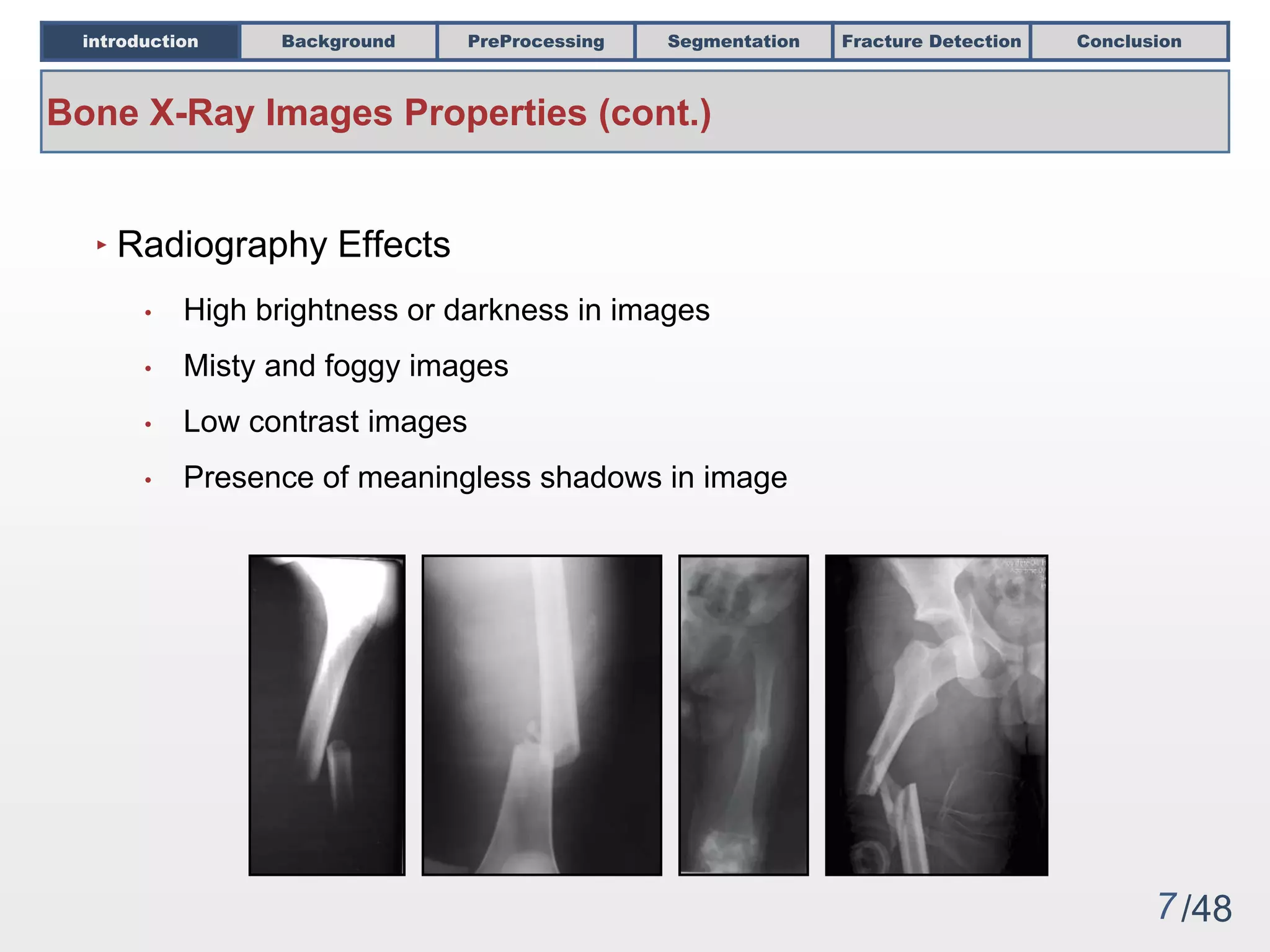 Master thesis - Long Bone Segmentation and Fracture Detection in X-ray ...