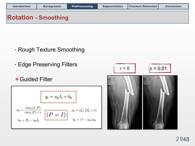 Master thesis - Long Bone Segmentation and Fracture Detection in X-ray ...