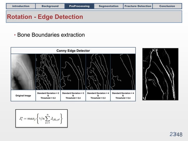 Master thesis - Long Bone Segmentation and Fracture Detection in X-ray ...
