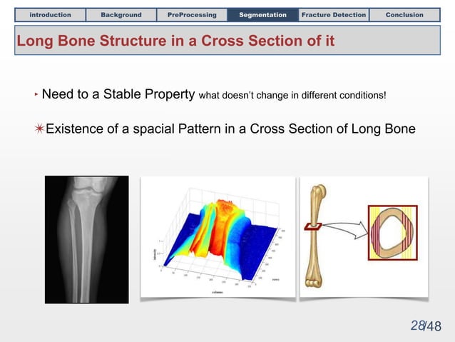 Master Thesis Long Bone Segmentation And Fracture Detection In X Ray