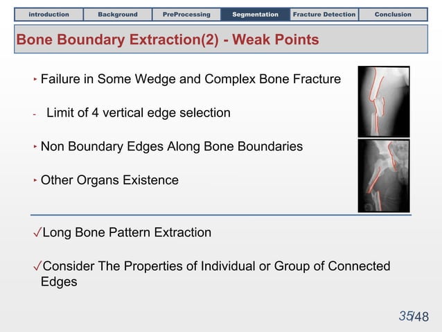 Master Thesis Long Bone Segmentation And Fracture Detection In X Ray