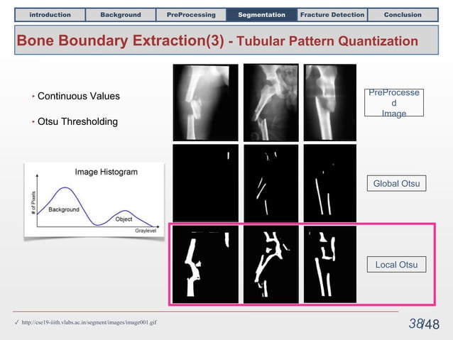 Master thesis - Long Bone Segmentation and Fracture Detection in X-ray Images | PPT