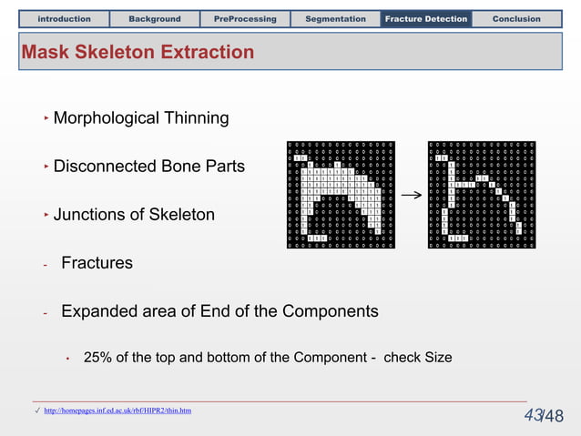 Master Thesis Long Bone Segmentation And Fracture Detection In X Ray Images Ppt