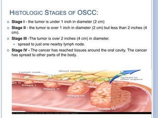 Role of neurotransmitter SP in progression of oral squamous cell ...