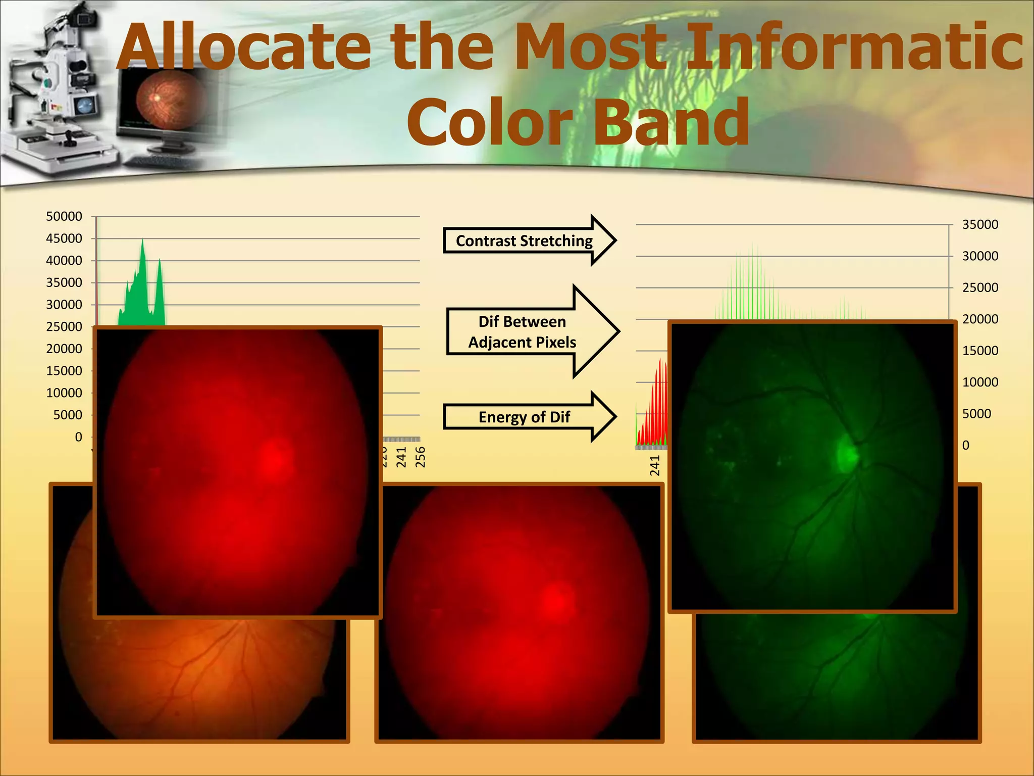 Automatic Detection Of Diabetic Maculopathy From Funduas Images Using