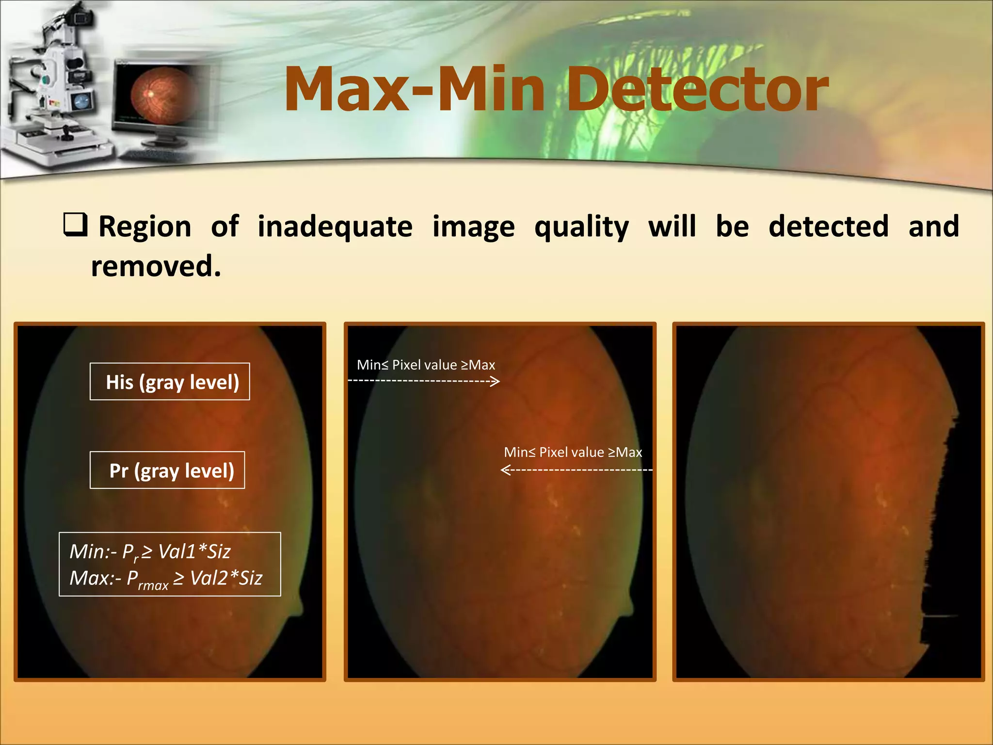 Automatic Detection of Diabetic Maculopathy from Fundus Images Using Image Analysis Techniques | PPT