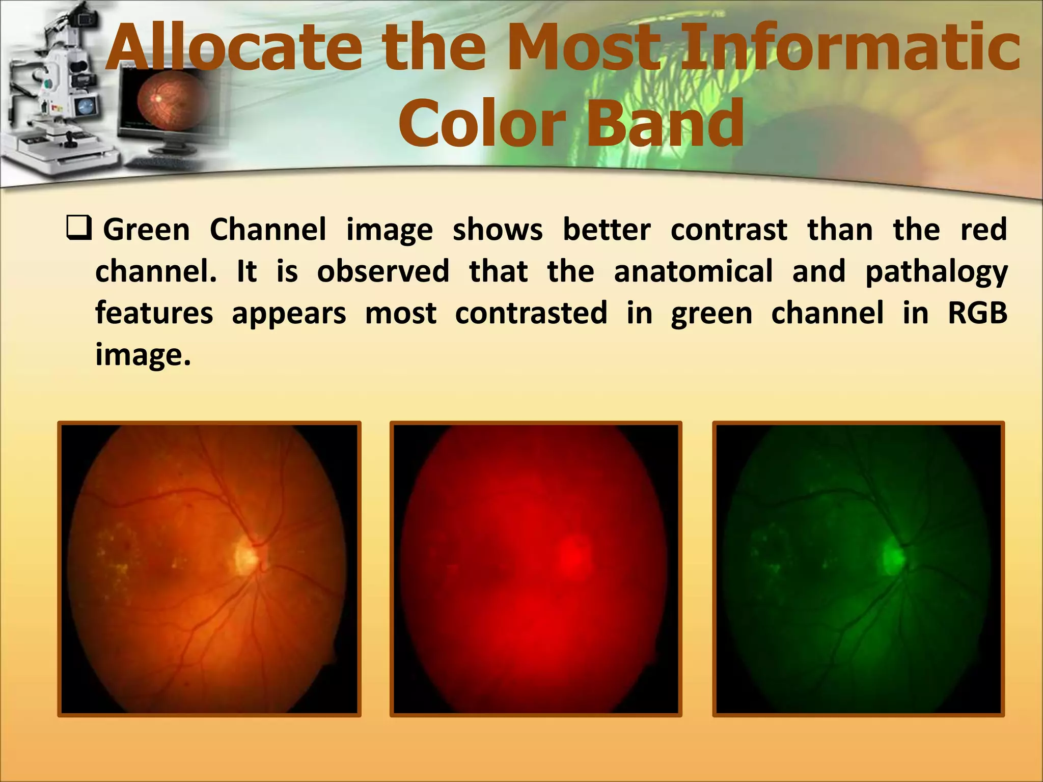 Automatic Detection of Diabetic Maculopathy from Fundus Images Using Image Analysis Techniques | PPT