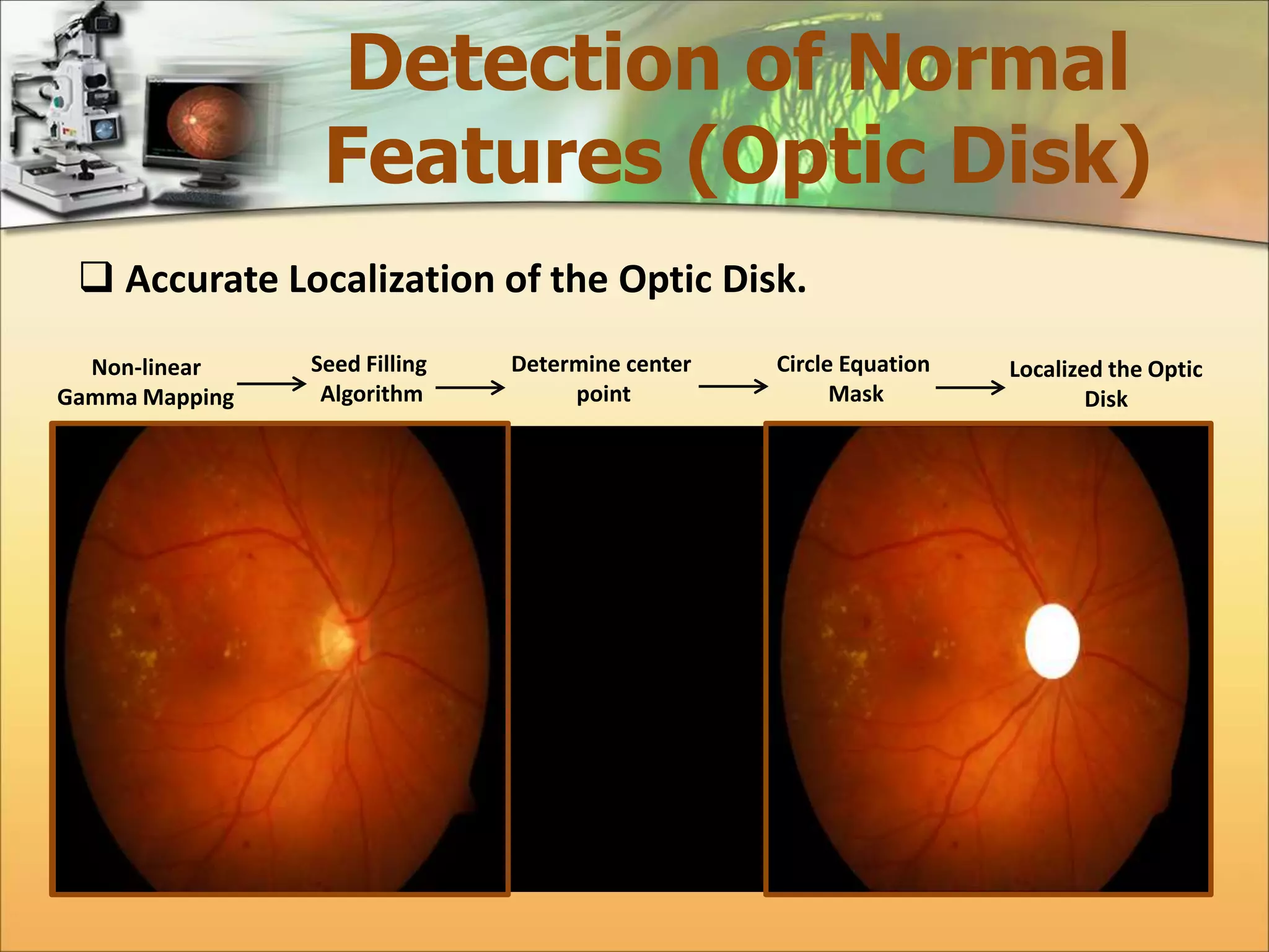 Automatic Detection of Diabetic Maculopathy from Fundus Images Using Image Analysis Techniques | PPT