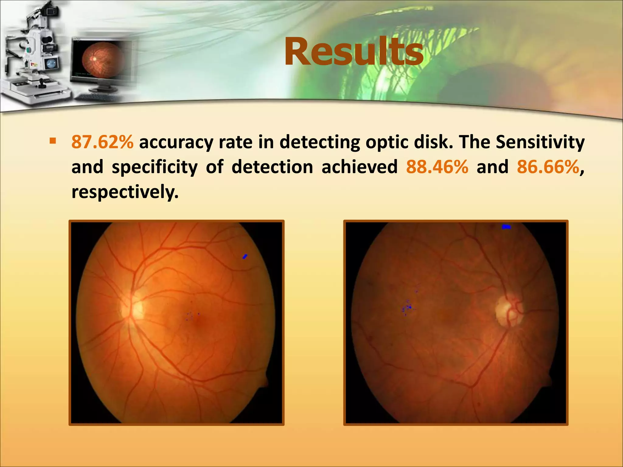 Automatic Detection of Diabetic Maculopathy from Fundus Images Using Image Analysis Techniques | PPT
