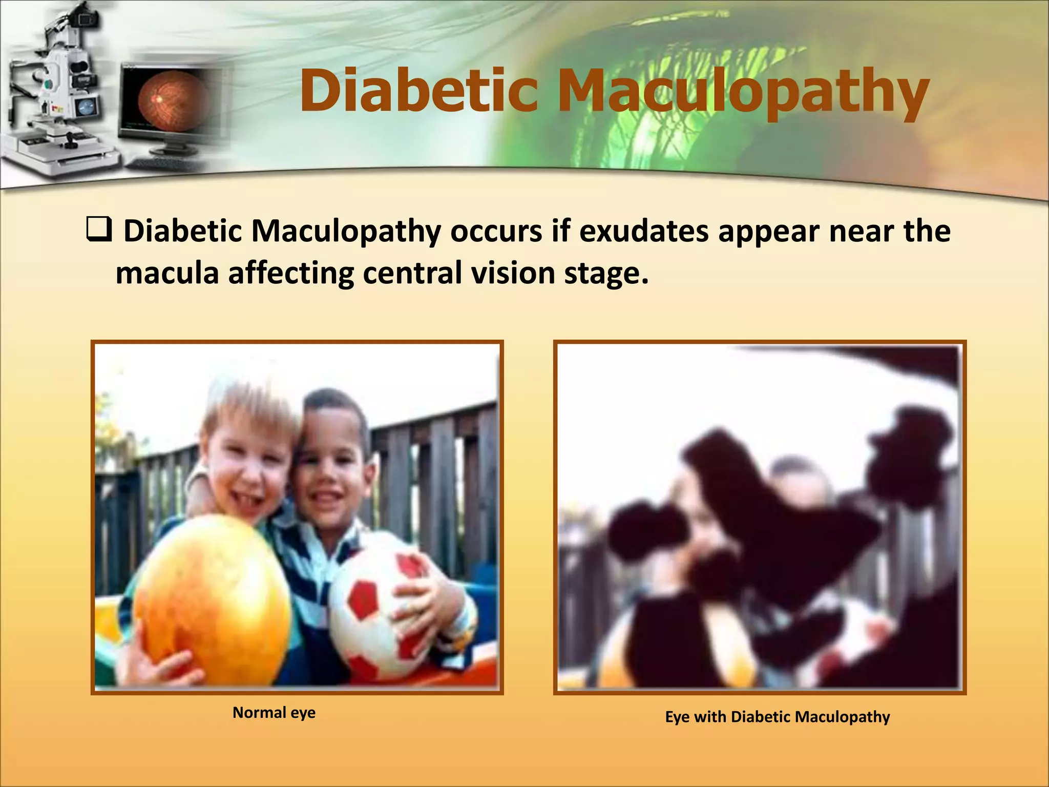 Automatic Detection of Diabetic Maculopathy from Fundus Images Using Image Analysis Techniques | PPT