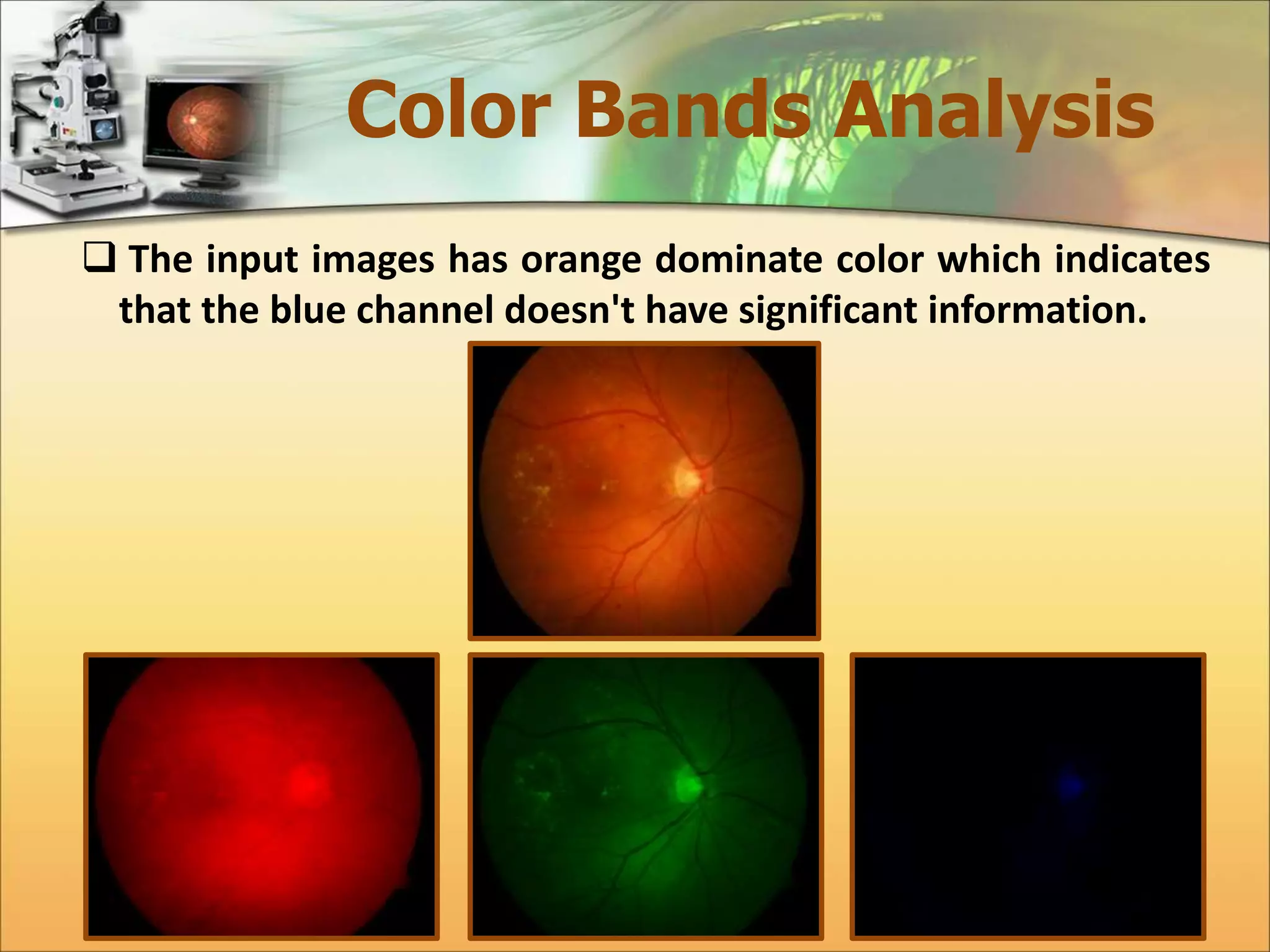 Automatic Detection of Diabetic Maculopathy from Fundus Images Using Image Analysis Techniques | PPT