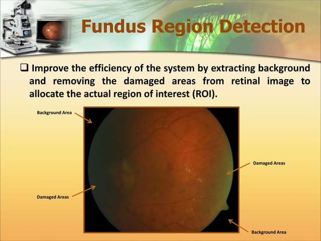 Automatic Detection Of Diabetic Maculopathy From Fundus Images Using Image Analysis Techniques Ppt