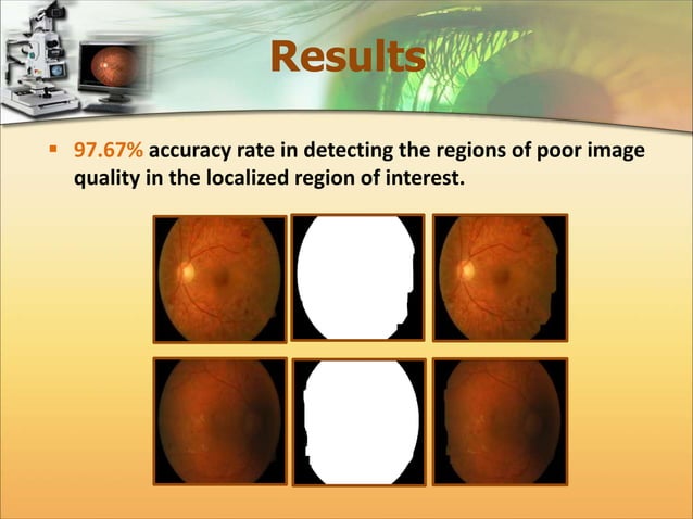 Automatic Detection of Diabetic Maculopathy from Fundus Images Using Image Analysis Techniques | PPT