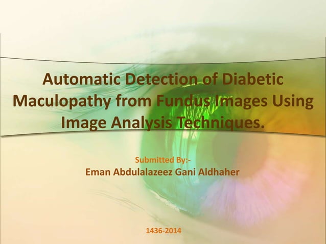 Automatic Detection of Diabetic Maculopathy from Fundus Images Using Image Analysis Techniques