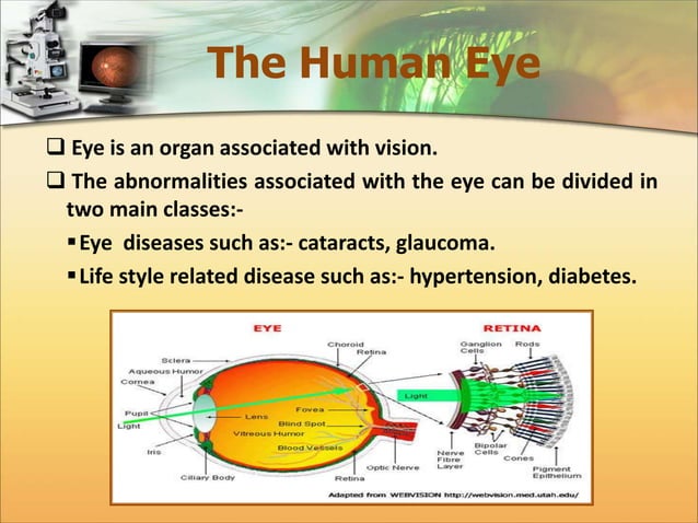 Automatic Detection of Diabetic Maculopathy from Fundus Images Using Image Analysis Techniques