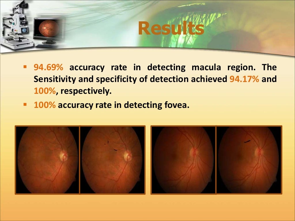 Automatic Detection Of Diabetic Maculopathy From Fundus Images Using