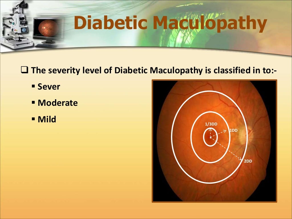 Automatic Detection Of Diabetic Maculopathy From Fundus Images Using