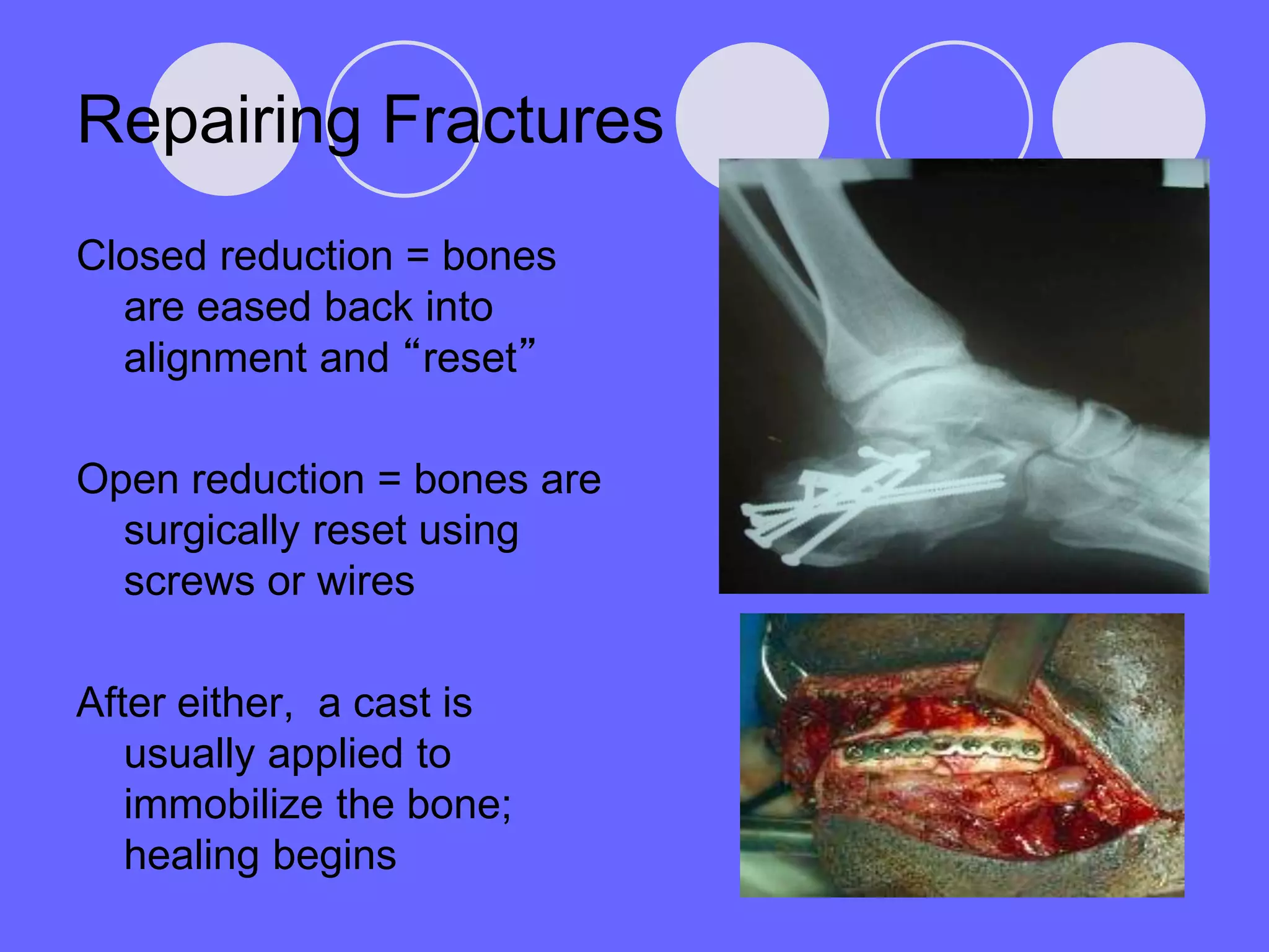 The Skeletal System (whole)2.ppt