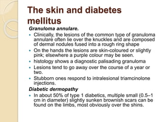 The skin in systemic disease | PPTX