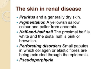 The skin in systemic disease | PPTX