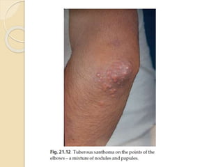 Cigarette Paper Skin