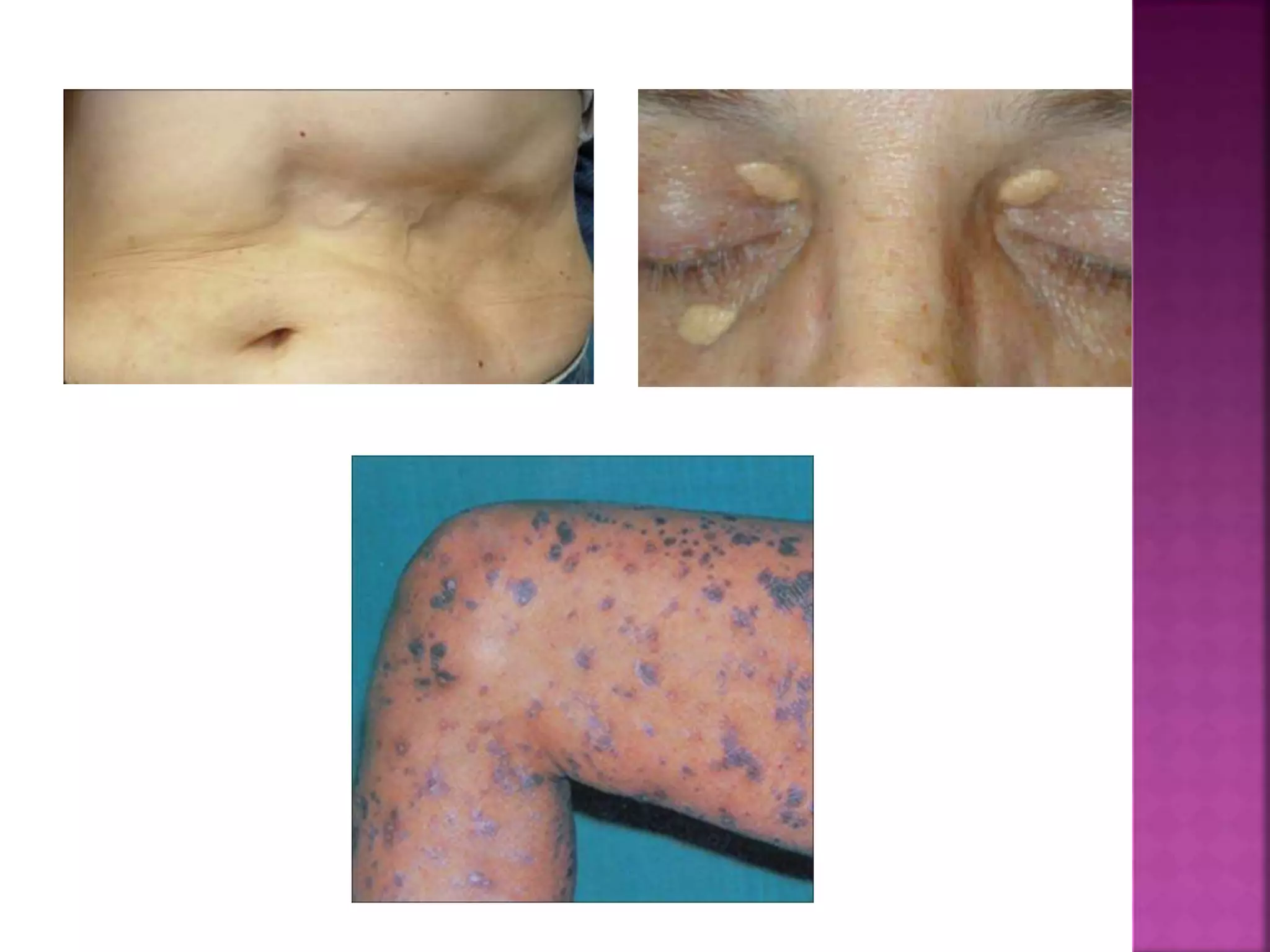 The skin manifestation of systemic diseases | PPTX