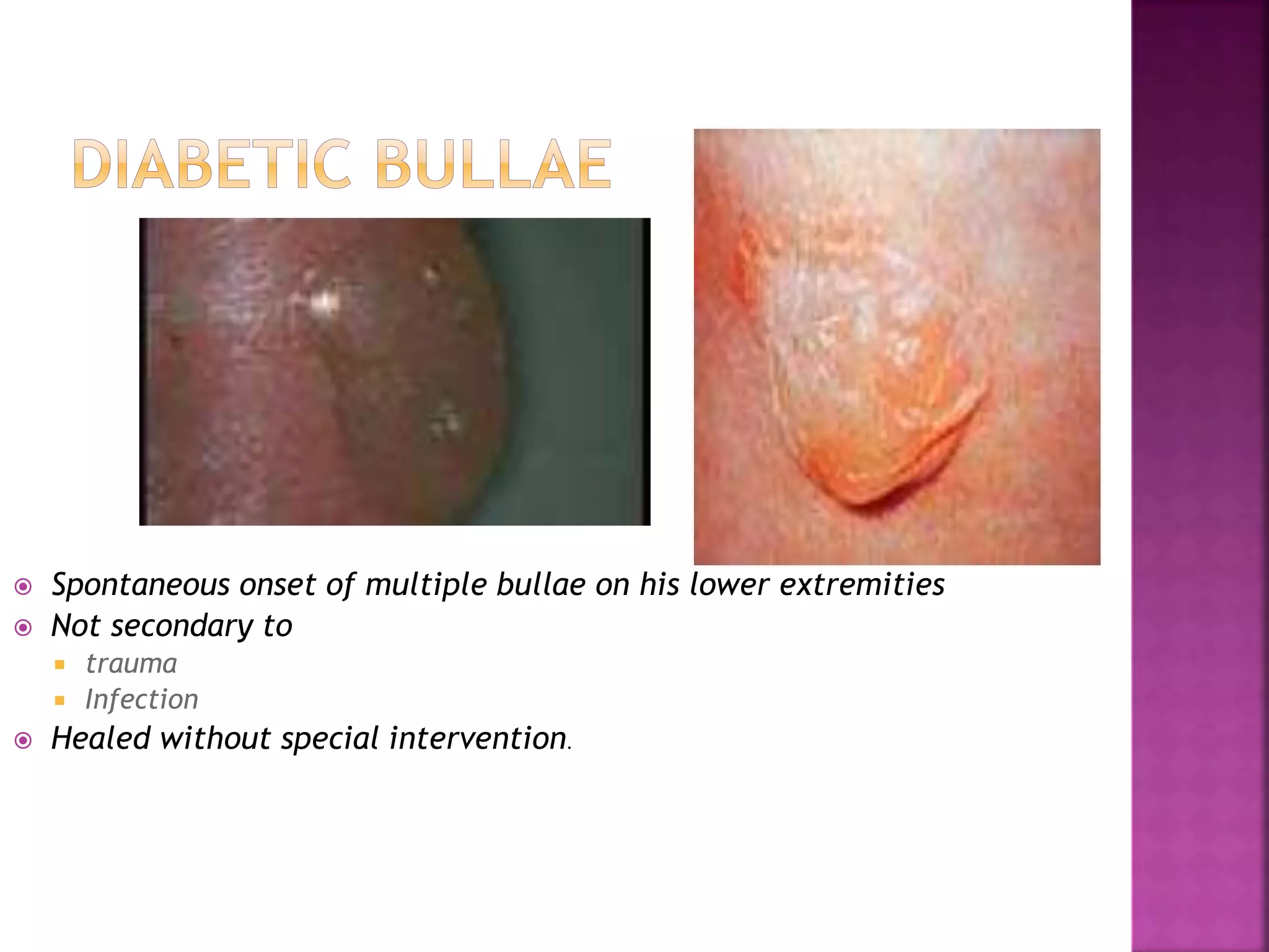 The skin manifestation of systemic diseases | PPTX