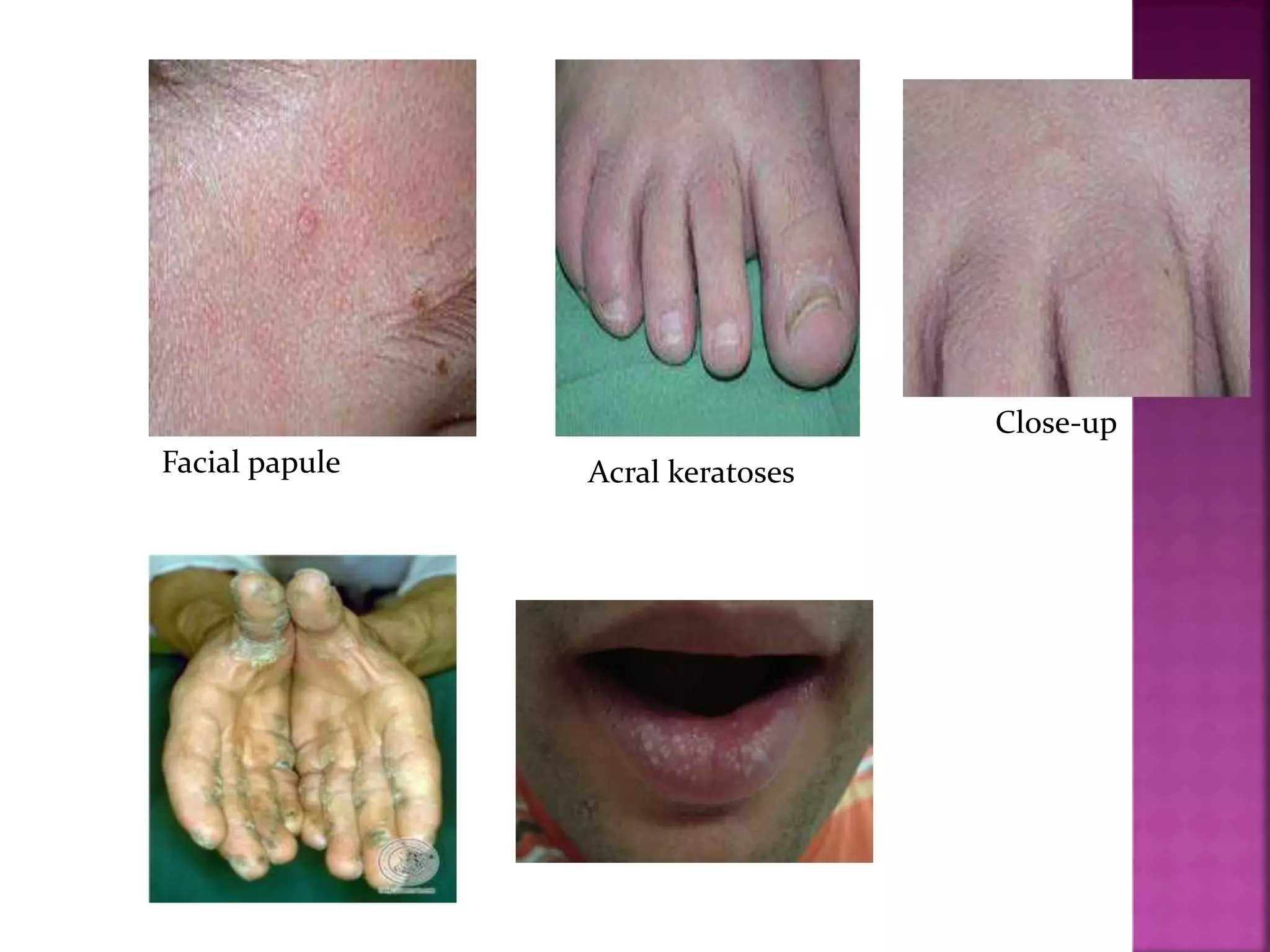 The skin manifestation of systemic diseases | PPTX