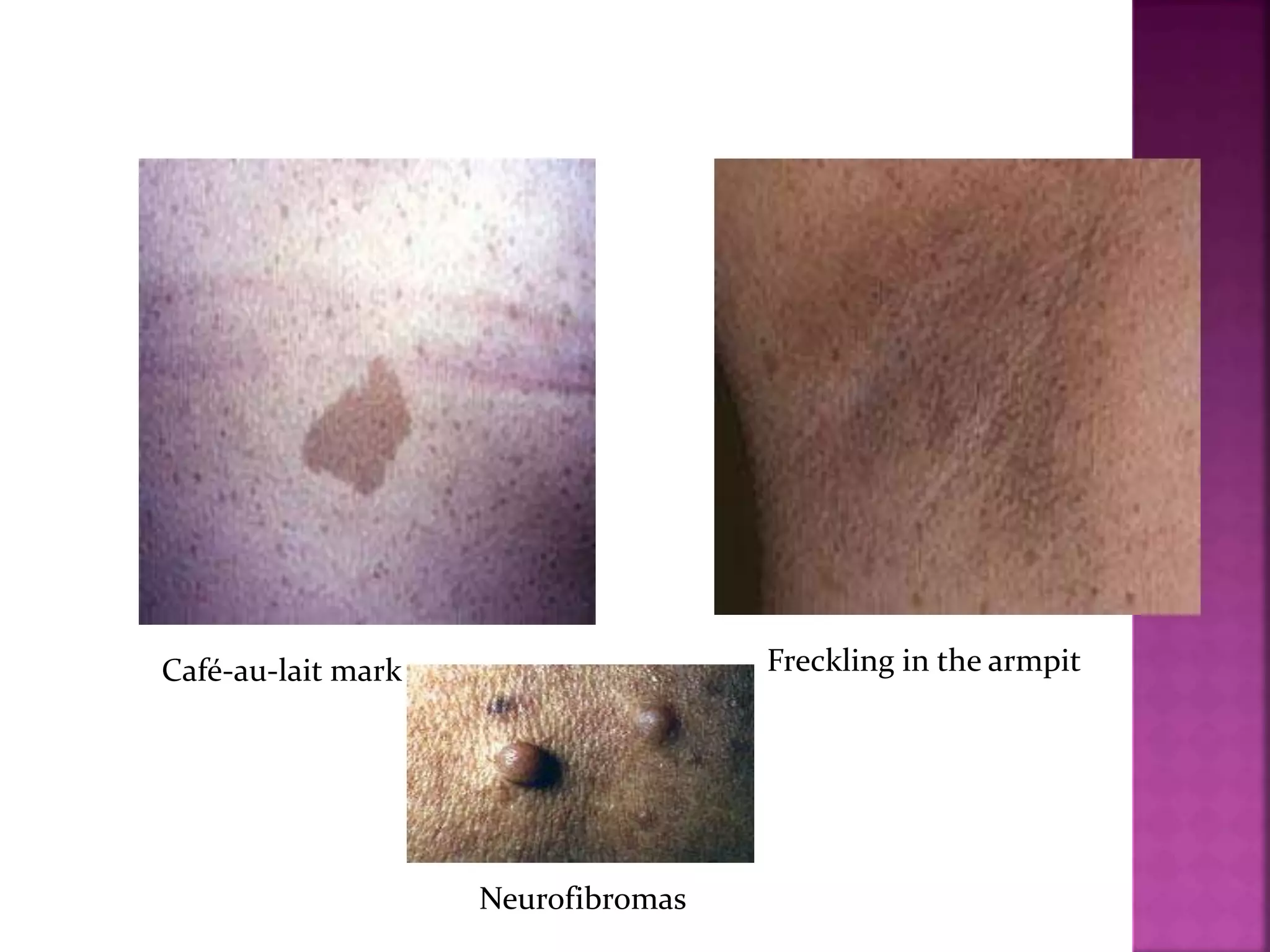 The skin manifestation of systemic diseases | PPTX