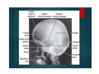 skull positioning | PPTX
