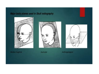 skull positioning | PPTX