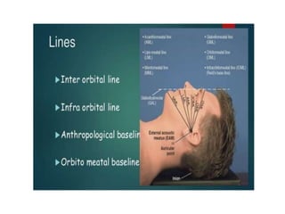 skull positioning | PPTX