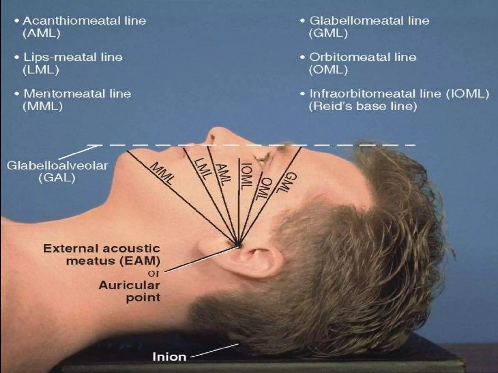 SKULL: Radiologic Positioning (Non-contrast) | PPTX