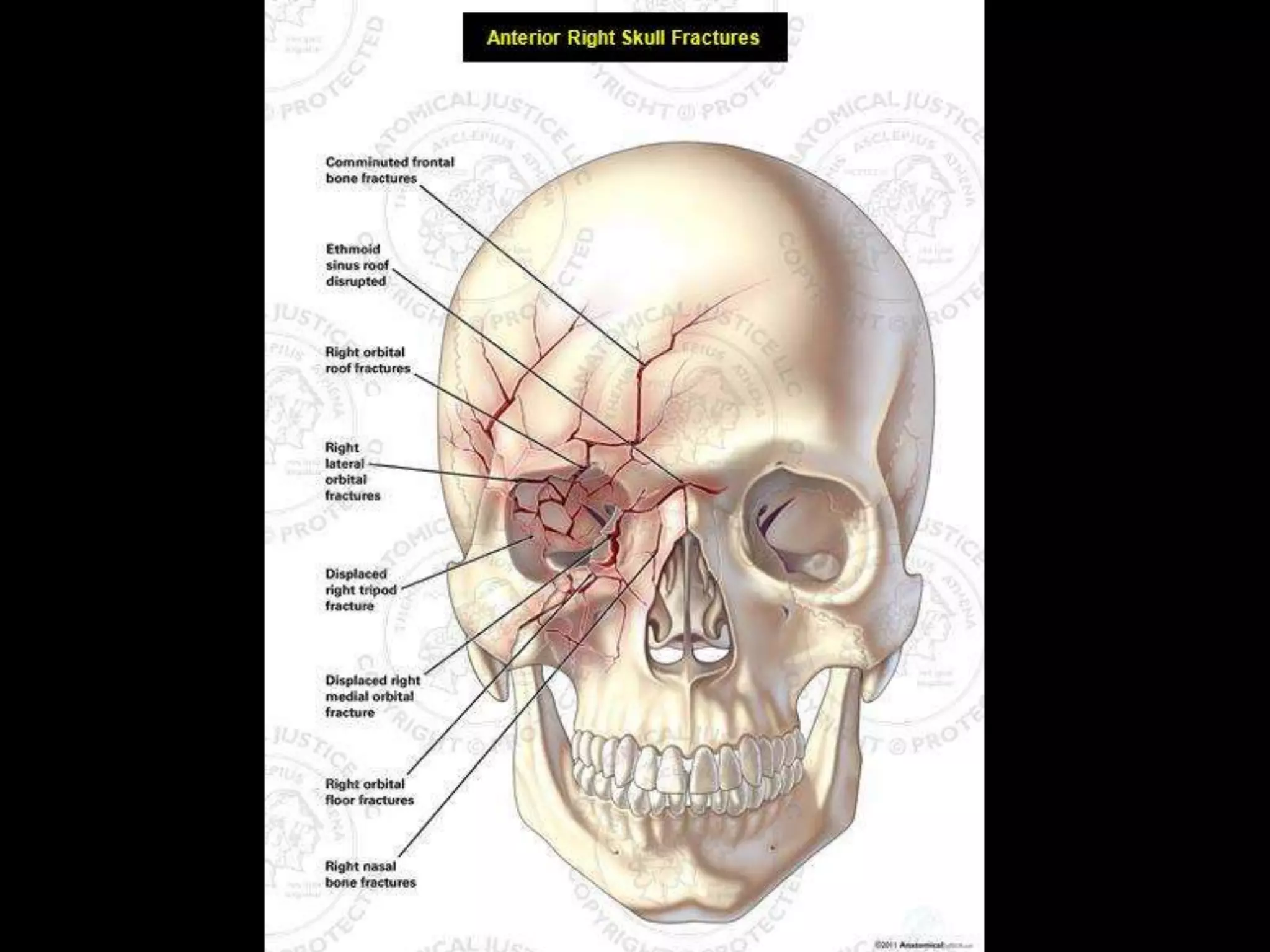 SKULL: Radiologic Positioning (Non-contrast) | PPTX