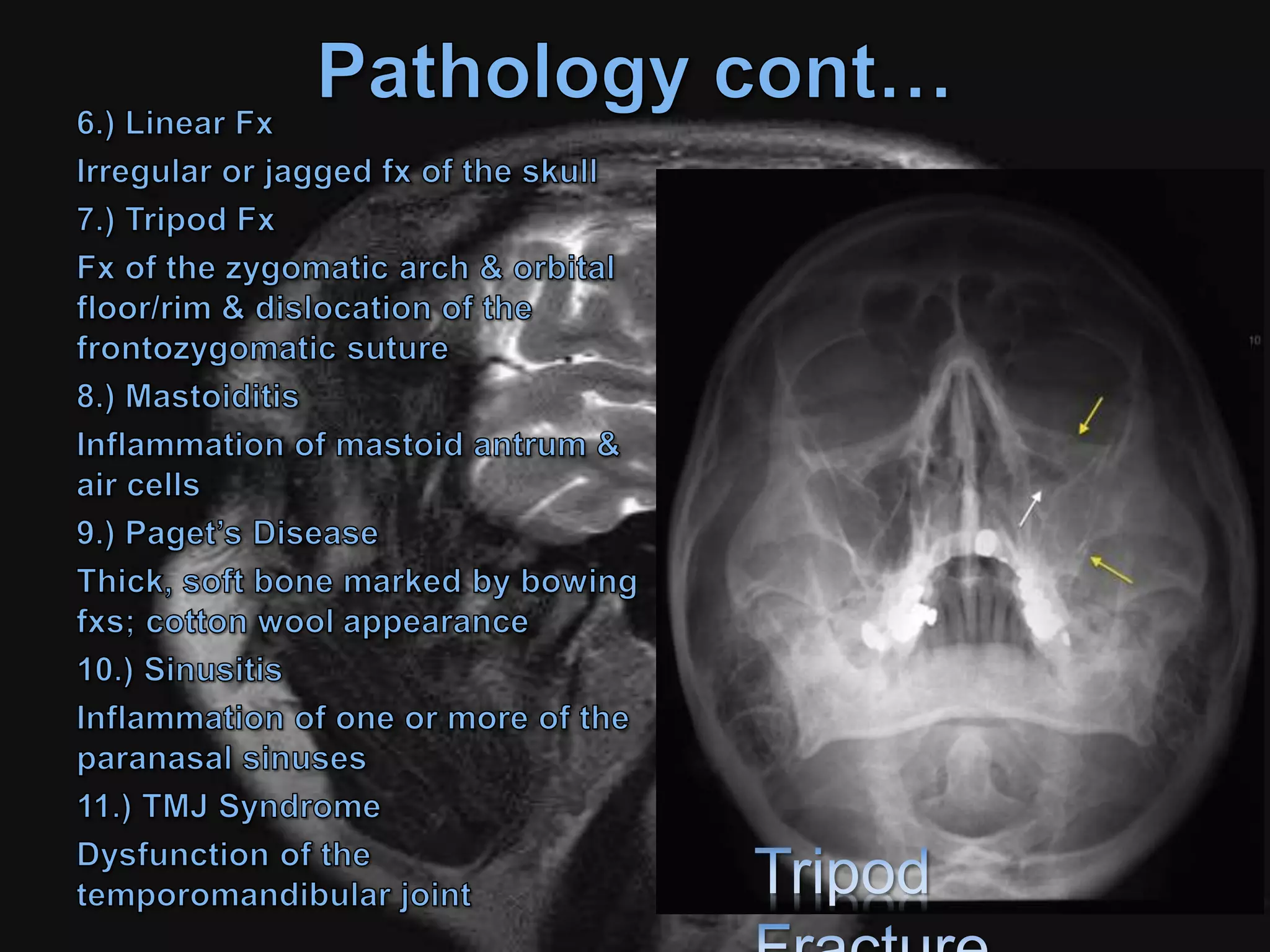 SKULL: Radiologic Positioning (Non-contrast) | PPTX