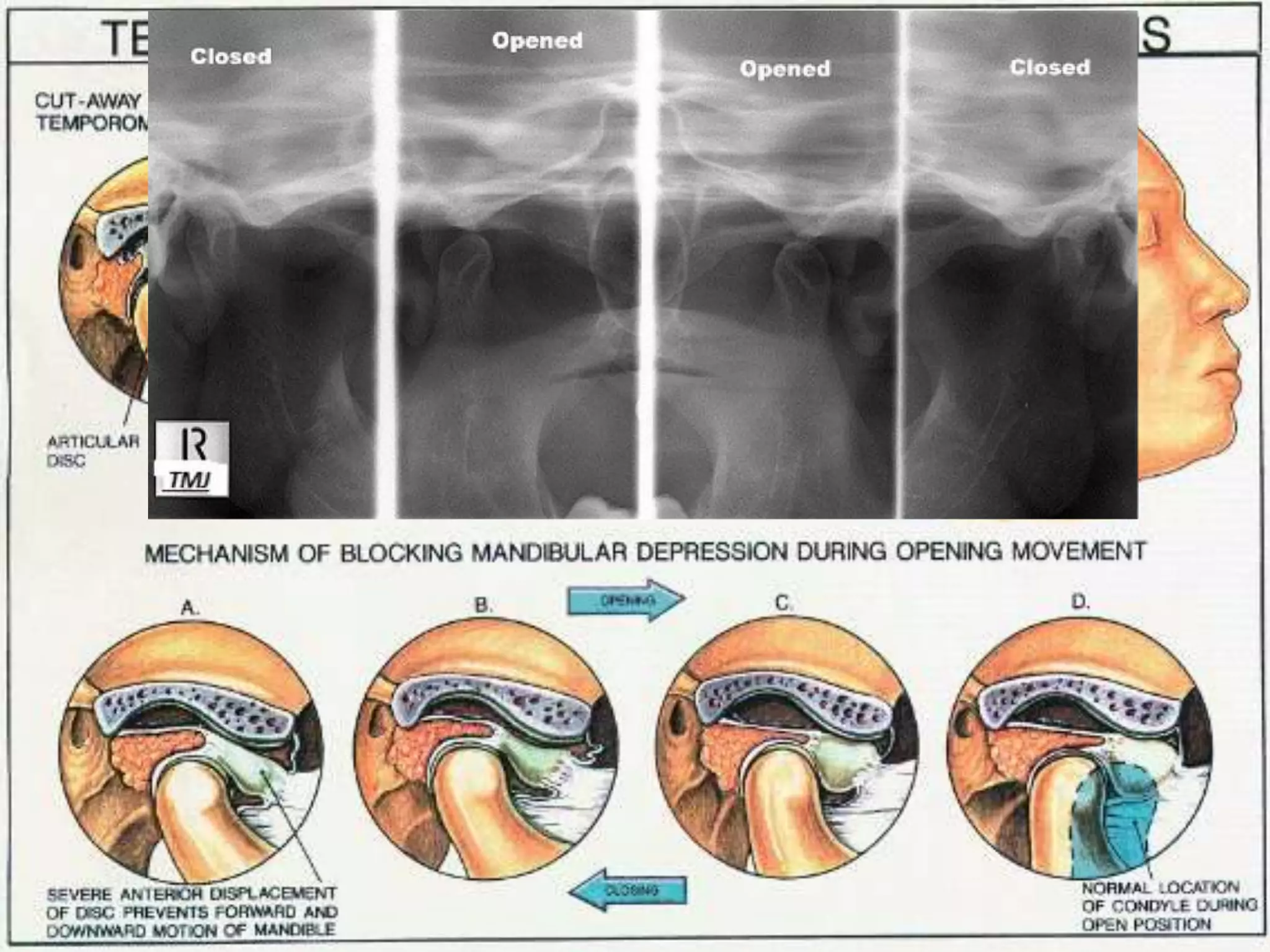 SKULL: Radiologic Positioning (Non-contrast) | PPTX